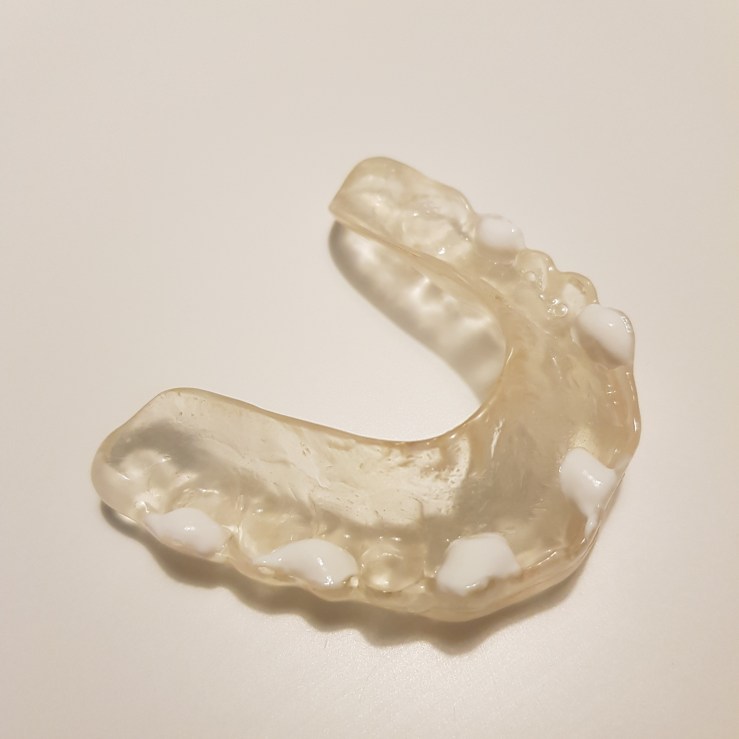 GC Tooth Mousse Review and Advice for Use – Dental Revelations